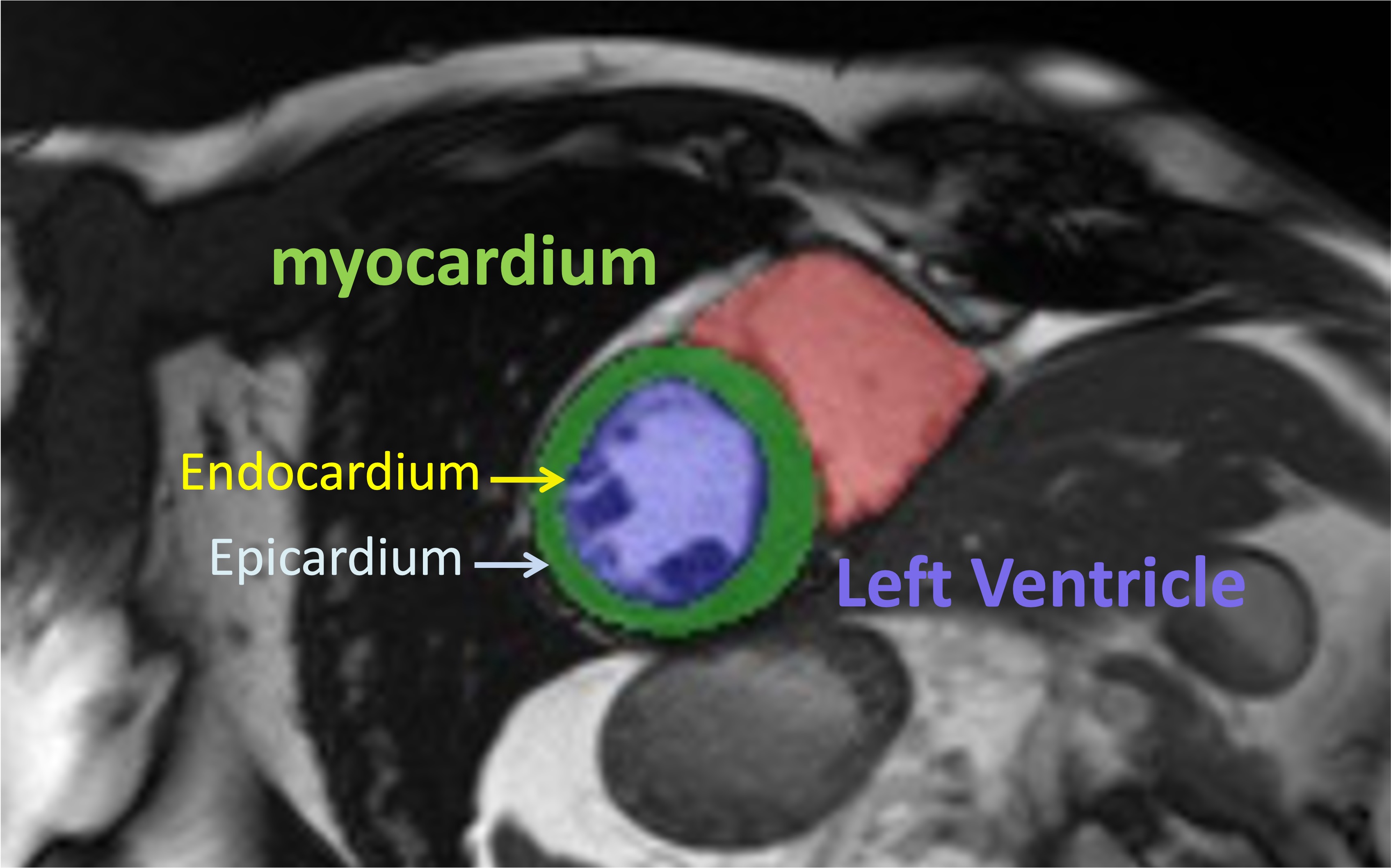 Cardiac Motion Analysis | Ping Lu
